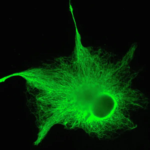 Astrocyte nerve cell. Fluorescent light micrograph of an