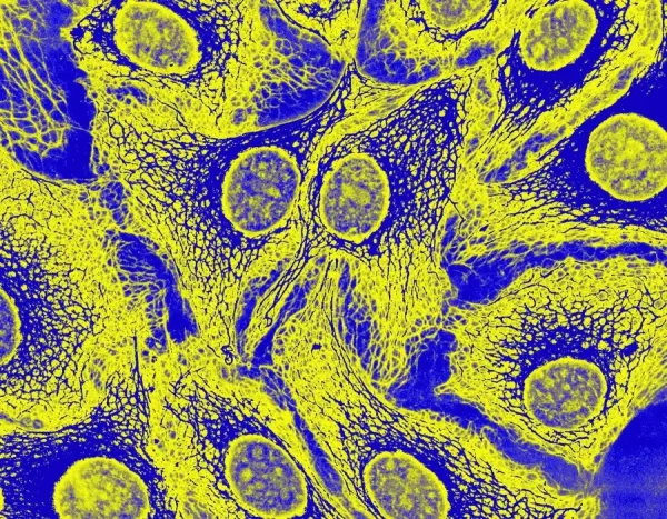 Keratinocyte skin cells, light micrograph Our beautiful Wall Art and ...