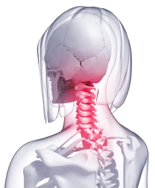 Neck pain, artwork F007 / 5673 Our beautiful Wall Art and Photo Gifts ...