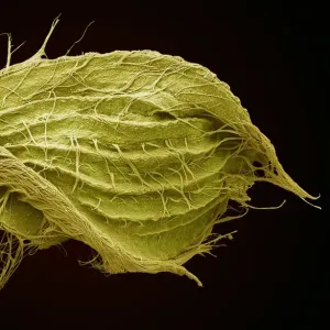 Mite, SEM. Mite. Coloured scanning electron micrograph (SEM)