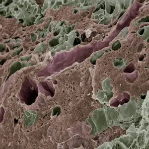 E Coli Induced Cell Death Photograph By Steve Gschmeissner