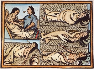 Smallpox Aztec